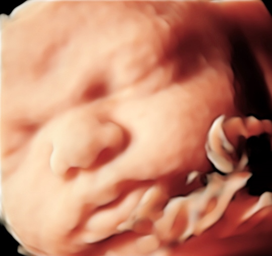 4D HD Ultrasound Image Gallery | Prenatal Universe Ultrasound